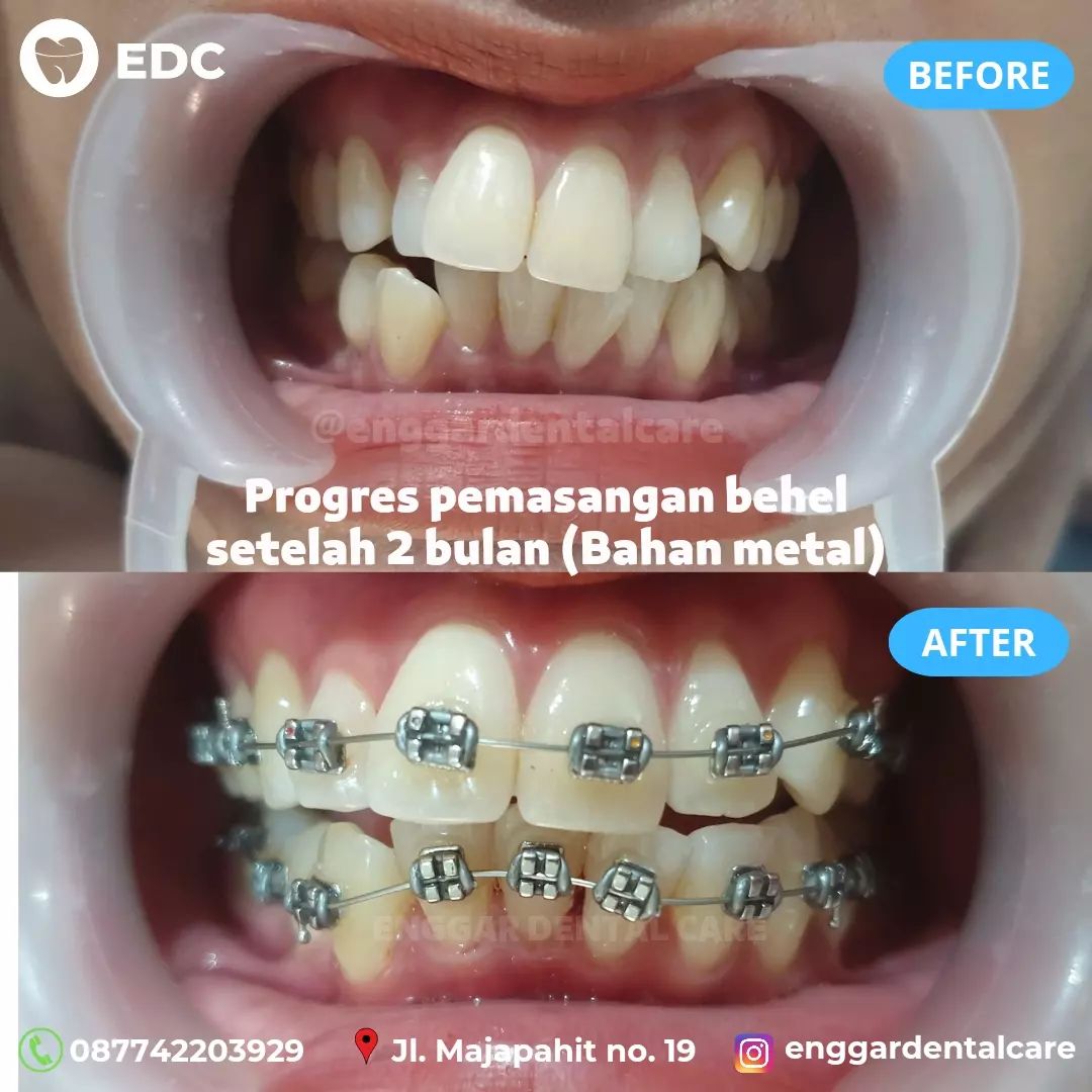 EDC - Enggar Dental Care